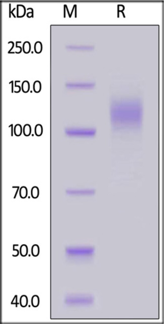 ACROBiosystems ACROBiosystems SARS-CoV-2 S1 protein (E484K, D614G), His | Fisher Scientific