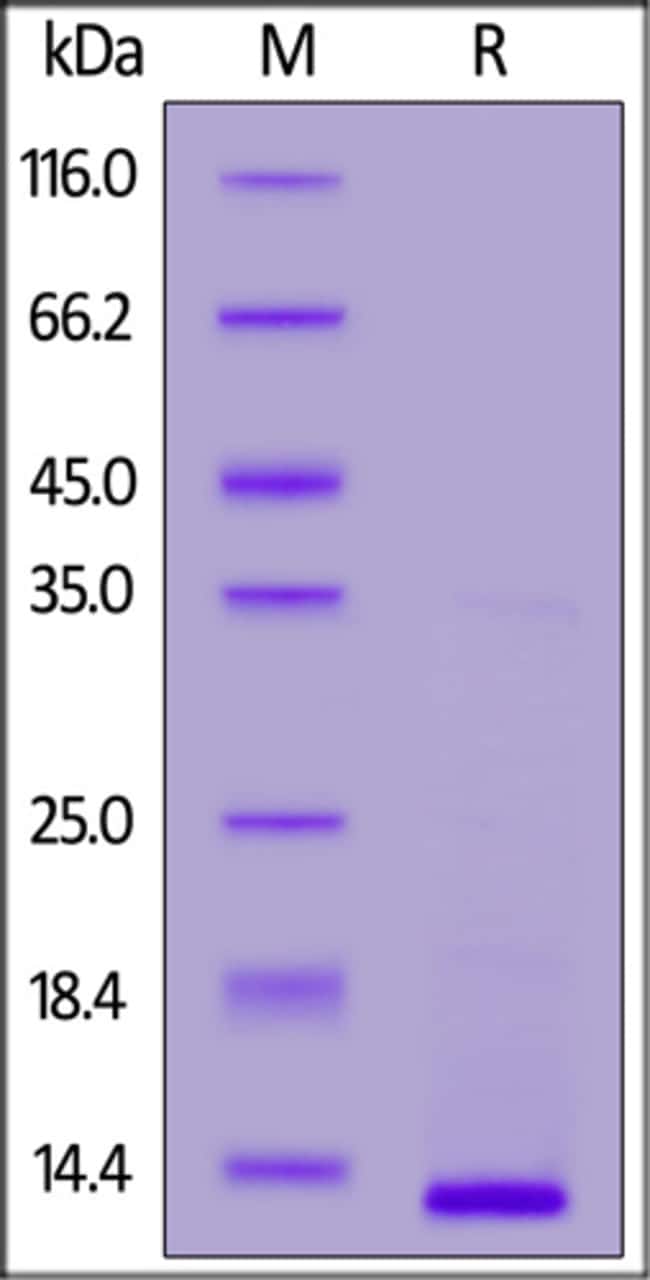 ACROBiosystems ACROBiosystems Human SDF-1 / CXCL12 Protein, His Tag, Quantity: | Fisher Scientific