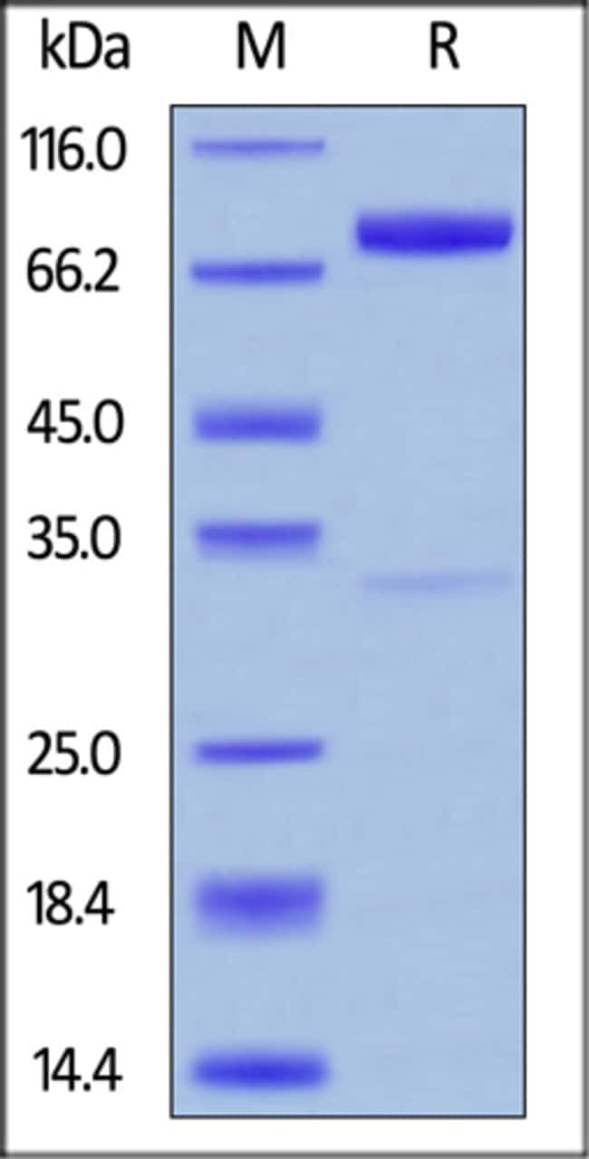 ACROBiosystems ACROBiosystems Human SIRP beta / CD172b Protein, Fc Tag, | Fisher Scientific