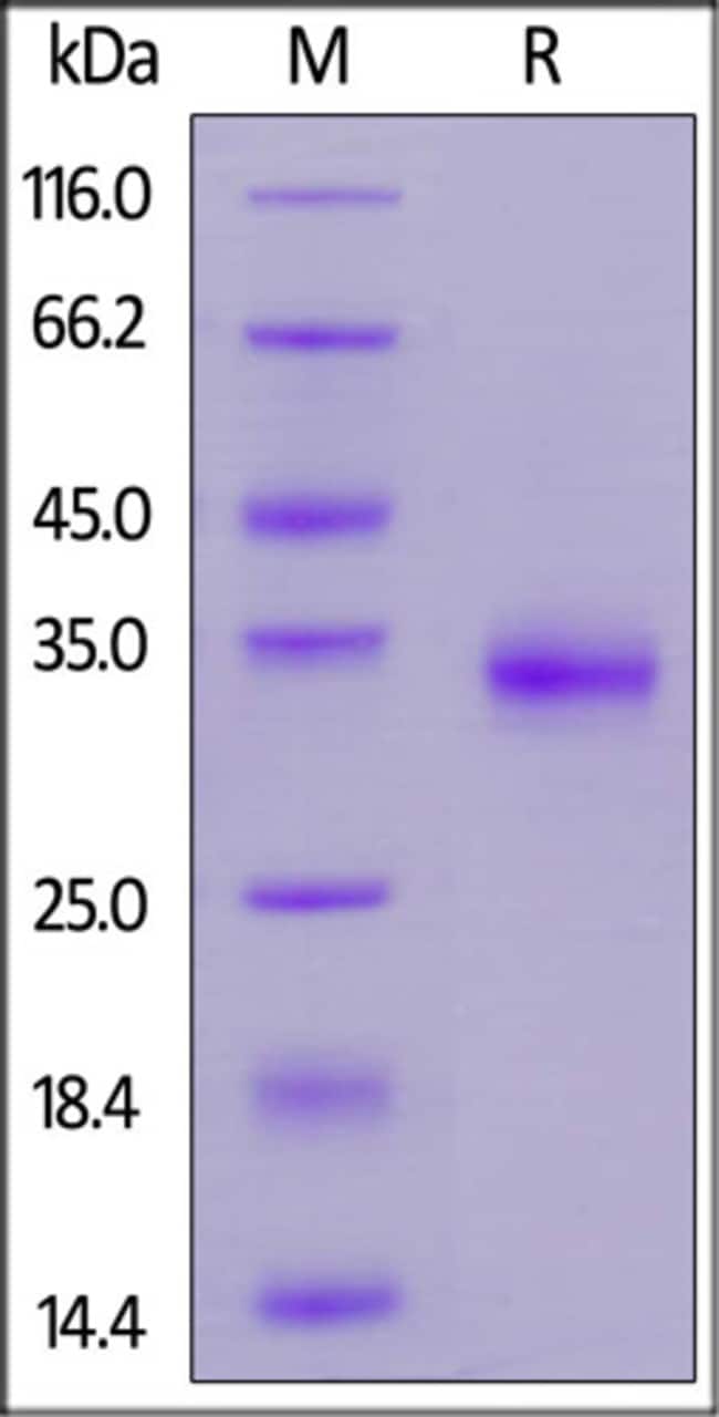 ACROBiosystems ACROBiosystems SARS-CoV-2 Spike RBD (K417N, L452R, T478K ... ACROBiosystems ACROBiosystems SARS-CoV-2 Spike RBD (K417N, L452R, T478K ...