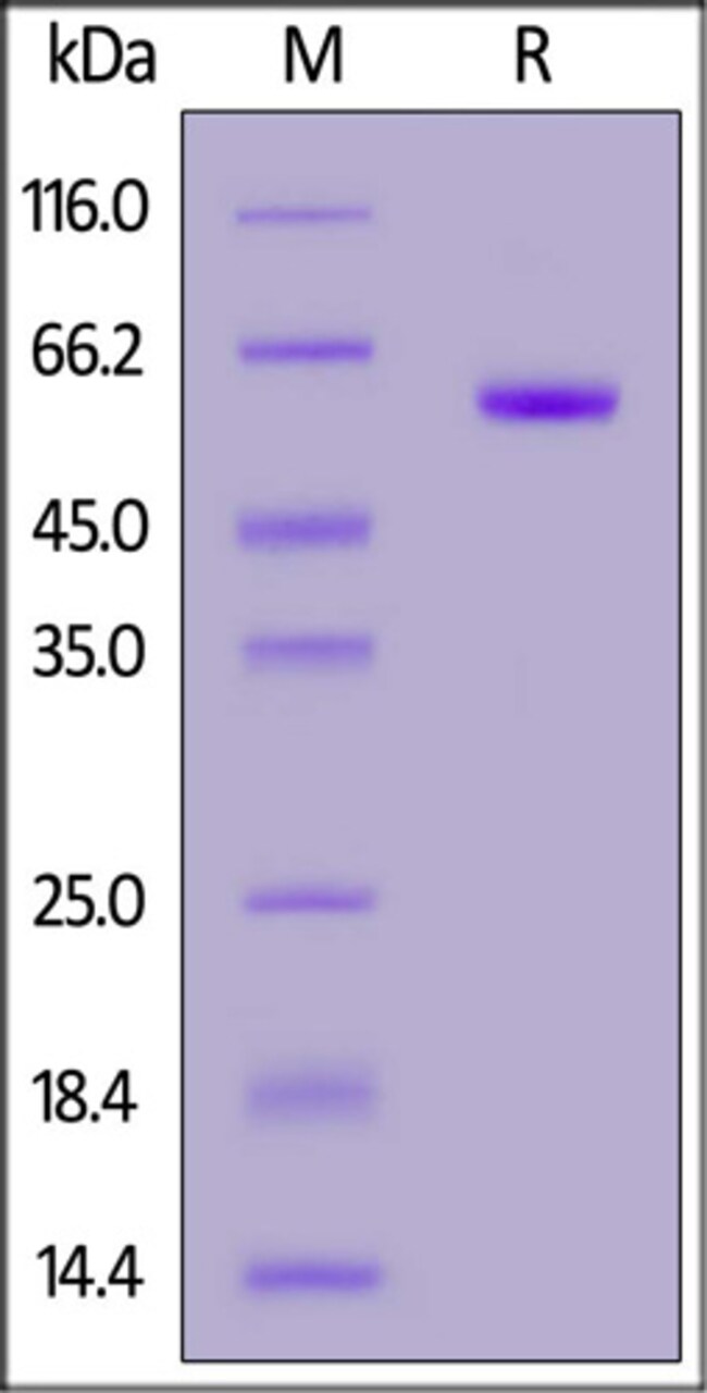ACROBiosystems ACROBiosystems SARS-CoV-2 Spike RBD (L452R, T478K), Fc ... ACROBiosystems ACROBiosystems SARS-CoV-2 Spike RBD (L452R, T478K), Fc ...