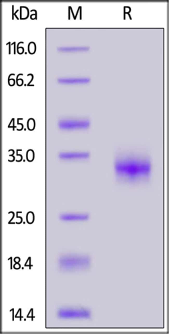 ACROBiosystems ACROBiosystems SARS-CoV-2 S protein RBD (K417T), His Tag ...