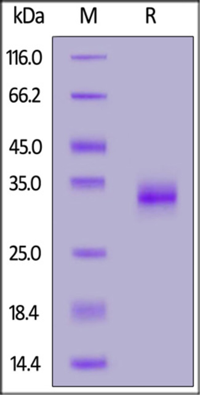 ACROBiosystems ACROBiosystems SARS-CoV-2 Spike RBD (L452R, E484Q), His | Fisher Scientific