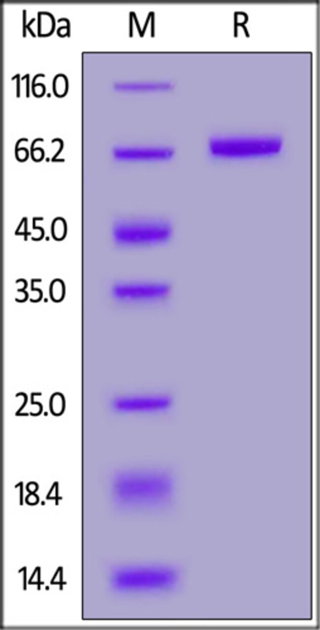 ACROBiosystems ACROBiosystems SARS-CoV-2 S protein RBD trimer, His Tag ...