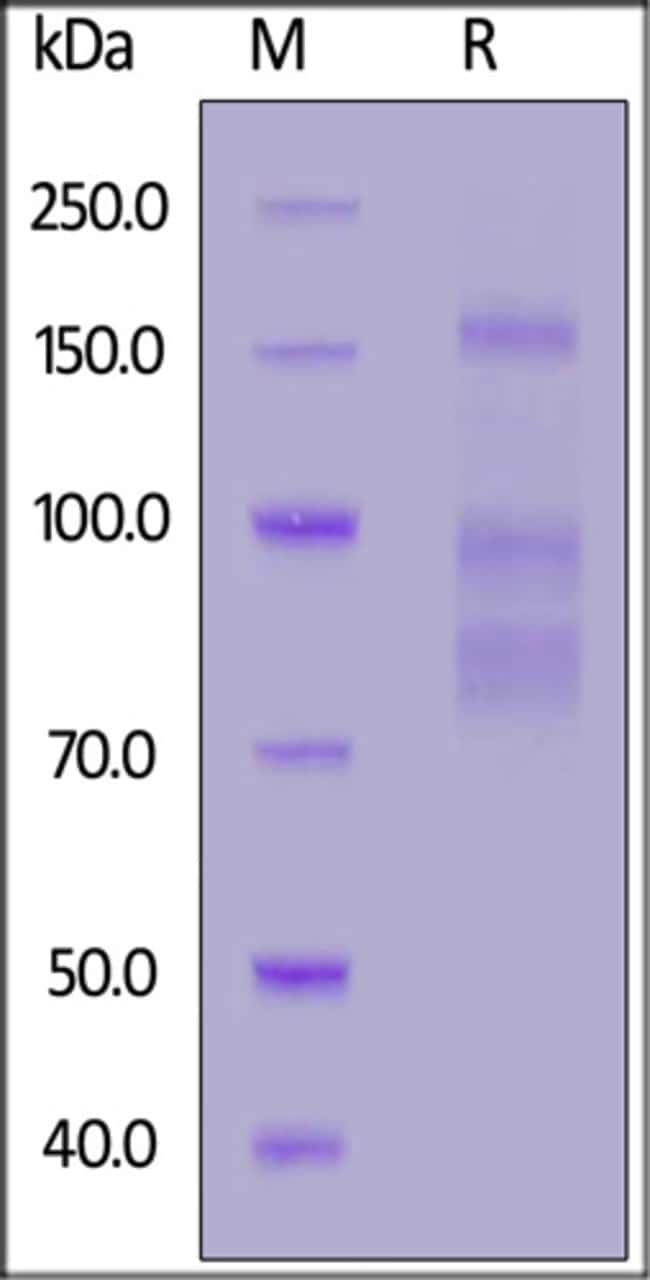 ACROBiosystems ACROBiosystems SARS-CoV-2 S protein (F817P, A892P, A899P ...