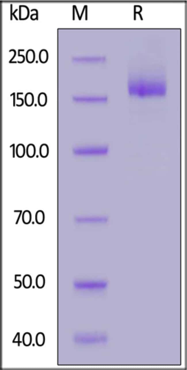 ACROBiosystems ACROBiosystems SARS-CoV-2 S protein (L18F, T20N, P26S ...