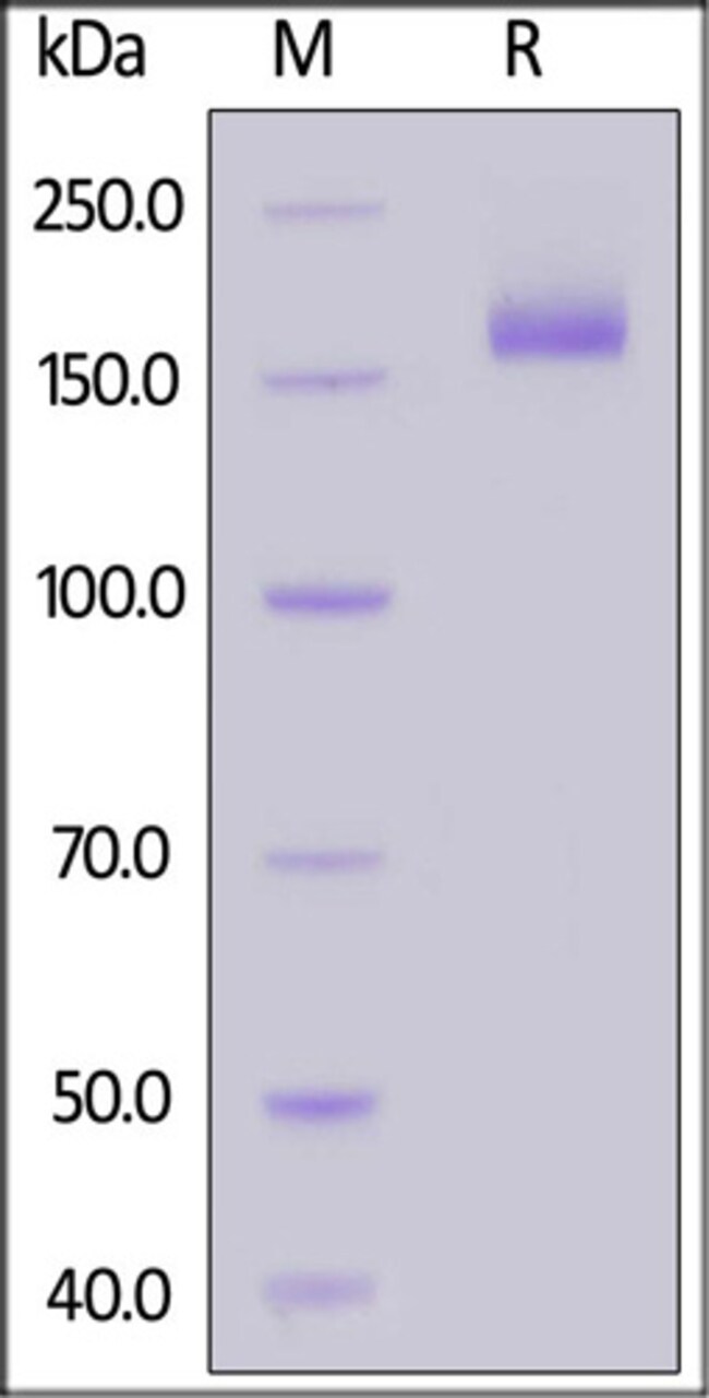 ACROBiosystems ACROBiosystems SARS-CoV-2 Spike Trimer (N501Y, D614G), His | Fisher Scientific