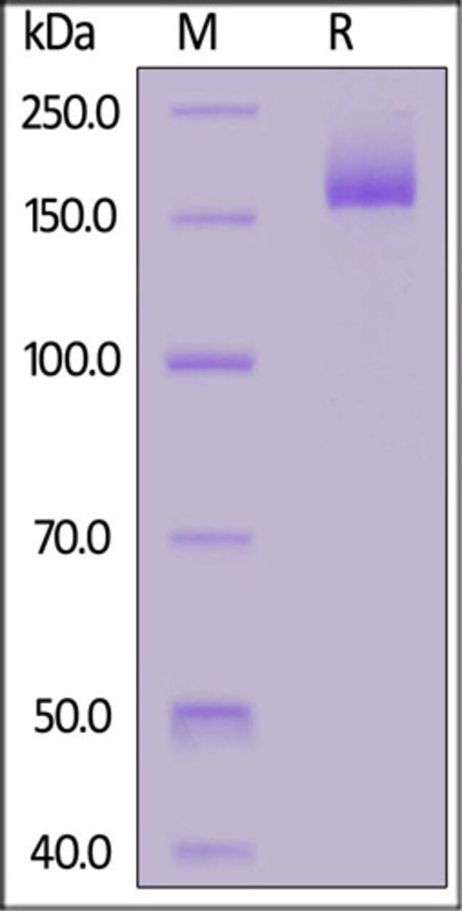 ACROBiosystems ACROBiosystems Biotinylated SARS-CoV-2 Spike Trimer ...