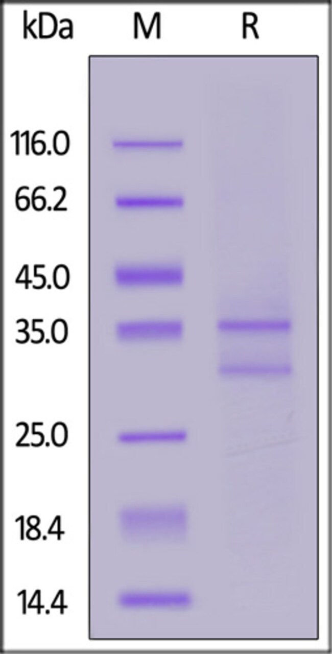 ACROBiosystems ACROBiosystems Human STEAP1 Full Length Protein, His Tag | Fisher Scientific