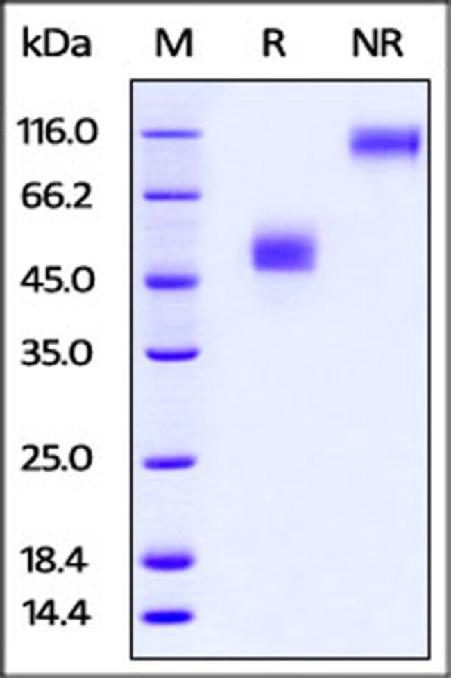 ACROBiosystems ACROBiosystems Rabbit TIGIT Protein, Fc Tag, Quantity: Each | Fisher Scientific