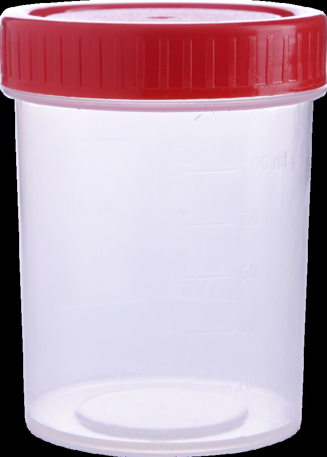 Foxx Life Sciences Abdos Sample Container, PP/PE, 60ml Red, Bulk, 400/CS | Fisher Scientific
