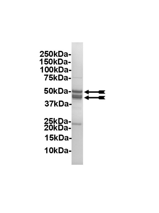 Eurofins DiscoverX Casein Kinase 2 Protein, Active Quantity: 10 μg ...