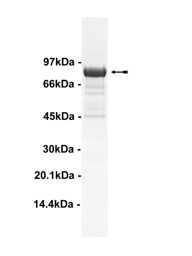 Eurofins DiscoverX Rsk1/MAPKAP Kinase 1a Protein, Active Quantity: 250 ...