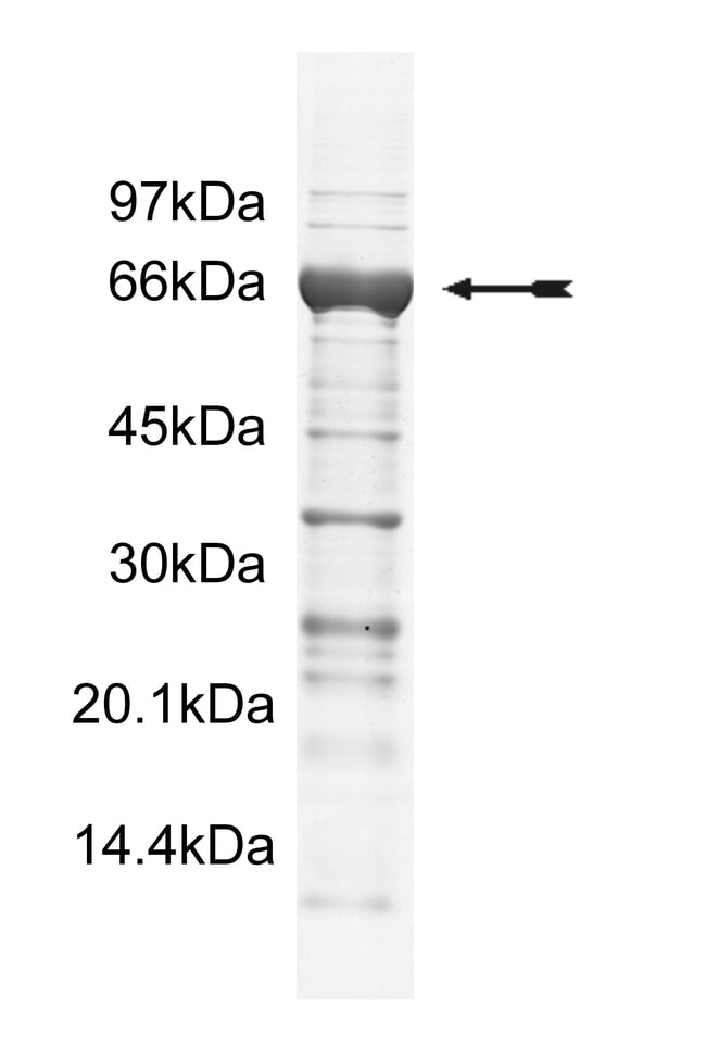 Eurofins DiscoverX PAK2 Protein, Active 10 μg | Buy Online | Eurofins ...