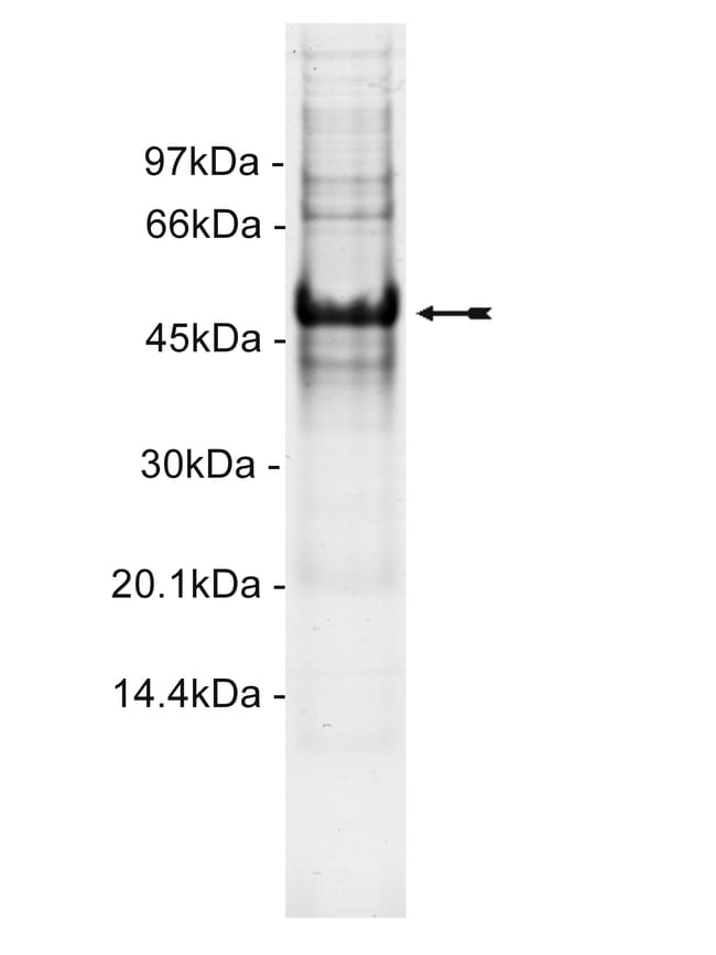 Eurofins DiscoverX Aurora A Protein, Active Quantity: 250 μg Eurofins ...