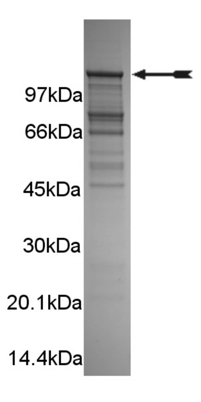 Eurofins DiscoverX Arg Human Protein, Active Quantity: 10 μg ...