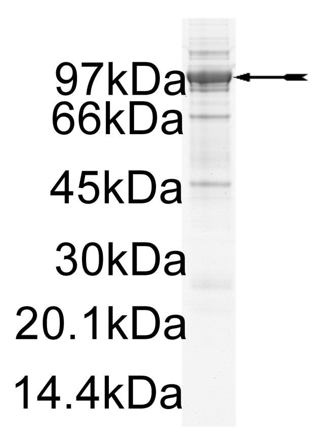 Eurofins DiscoverX MSK1 Protein, Active Quantity: 250 μg:Recombinant ...