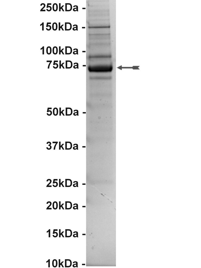 Eurofins DiscoverX BTK Protein, Active Quantity: 10 μg:Recombinant ...