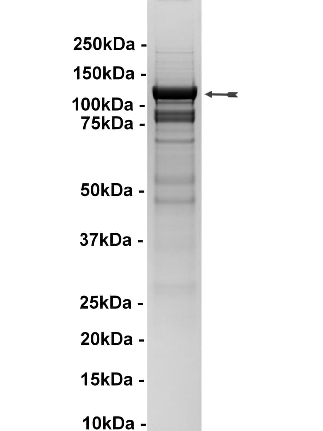 Eurofins DiscoverX Pyk2 Protein, Active Quantity: 250 μg:Recombinant ...