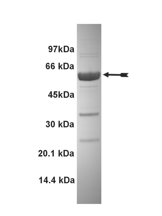Eurofins DiscoverX PAK4 Protein, Active 250 μg | Buy Online | Eurofins ...