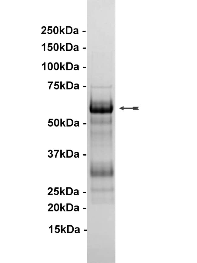 Eurofins DiscoverX PIM2 Protein, Active Quantity: 250 μg:Recombinant ...