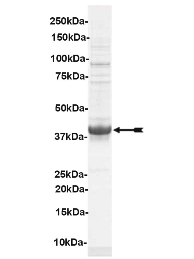 Eurofins DiscoverX MuSK Protein, Active Quantity: 10 μg Eurofins ...