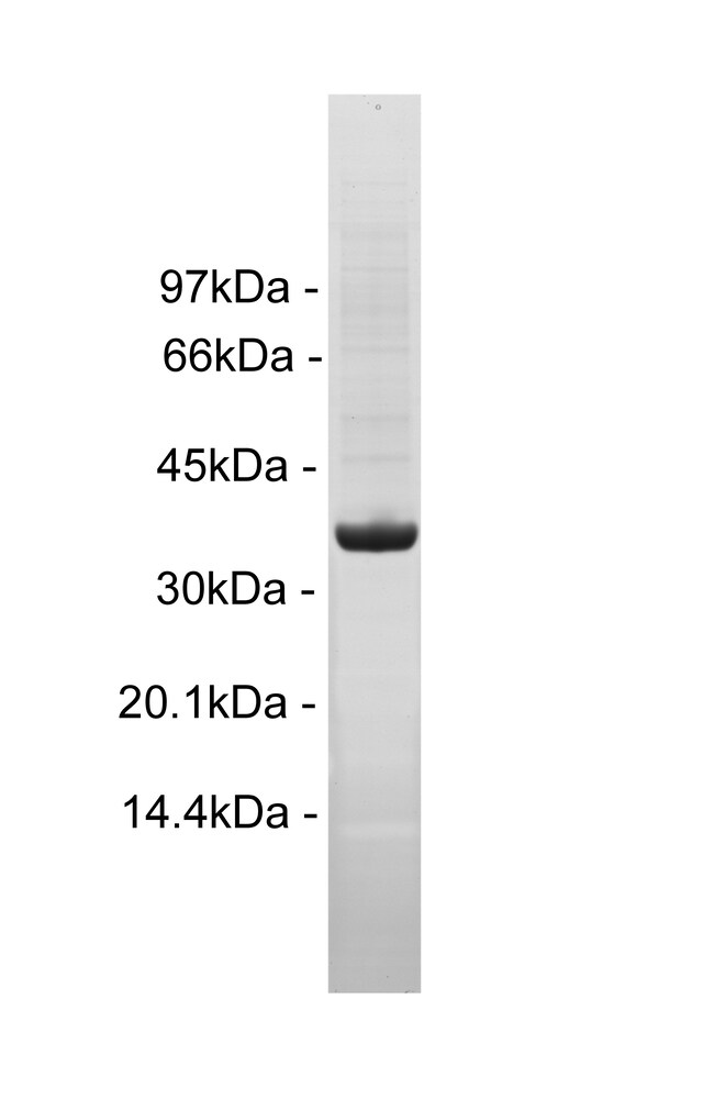 Eurofins DiscoverX Insulin Receptor Protein, Activated 10 μg | Buy ...