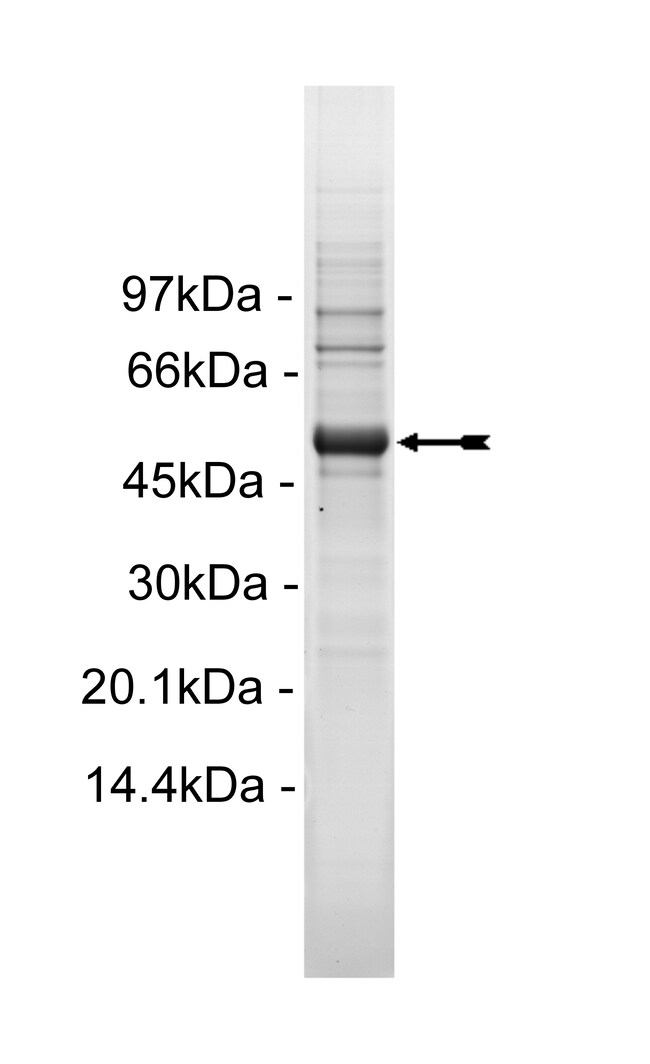 Eurofins DiscoverX Met (D1246N) Protein, Active 250 μg | Buy Online ...