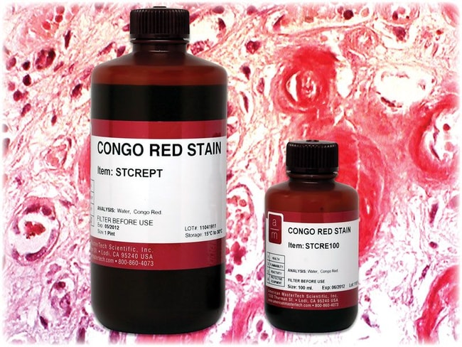 StatLab MasterTech Special Stain Kit, Congo Red Stain 1 L | Buy Online | StatLab | Fisher Scientific
