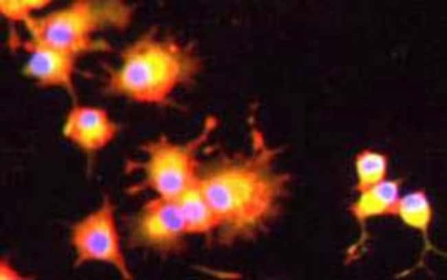 Angiopoietin 2 Polyclonal Antibody, Rockland 25 μL; Unconjugated ...