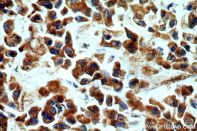 fibrosin Rabbit anti-Human, Mouse, Rat, Polyclonal, Proteintech 20 μL ...