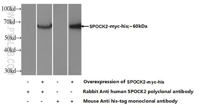 SPOCK2 Rabbit anti-Human, Polyclonal, Proteintech 20 μL; Unconjugated ...