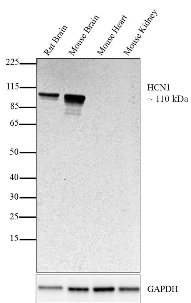 HCN1 Monoclonal Antibody (RTQ 7C3), eBioscience , Invitrogen 100 μg ...