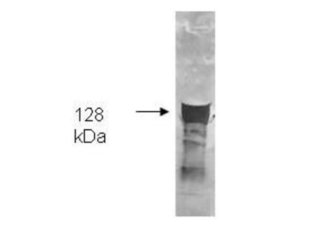 Glycerol Kinase Polyclonal Antibody, Rockland 100 μg; Unconjugated ...