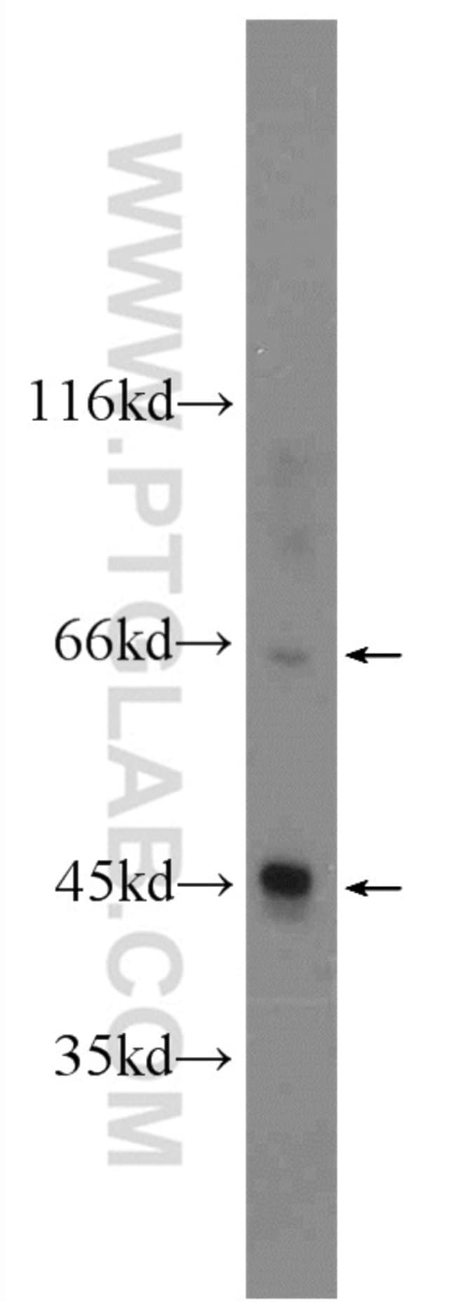 PVRL4 Rabbit anti-Human, Mouse, Polyclonal, Proteintech 150 μL ...