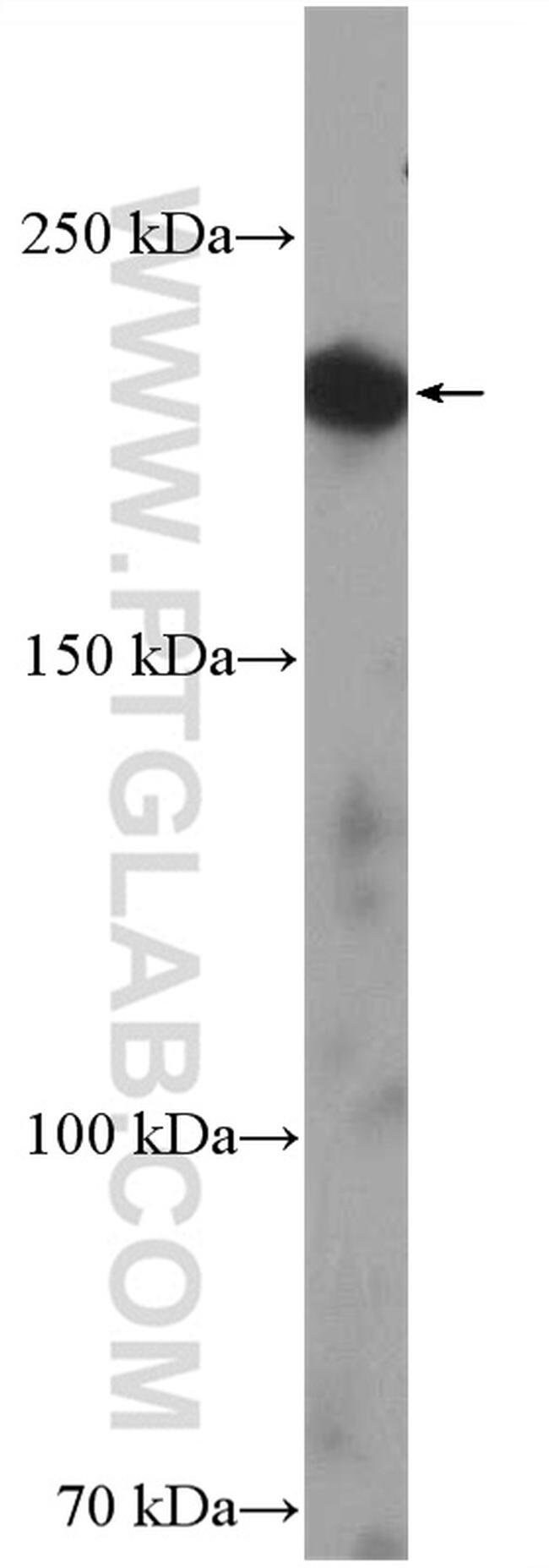 KIF21A Rabbit anti-Human, Mouse, Polyclonal, Proteintech 150 μL ...