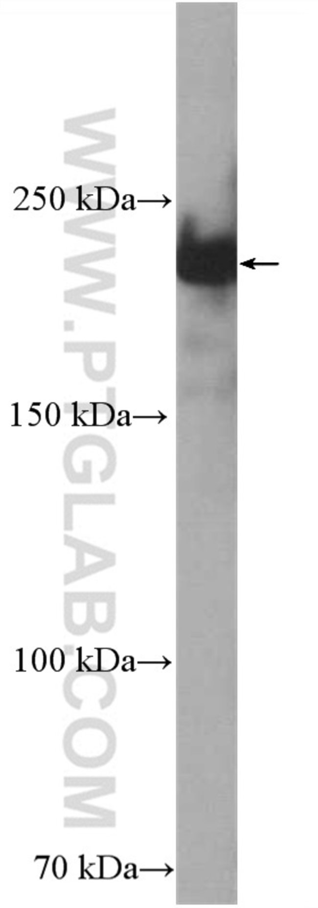 KIF21A Rabbit anti-Human, Mouse, Polyclonal, Proteintech 150 μL ...