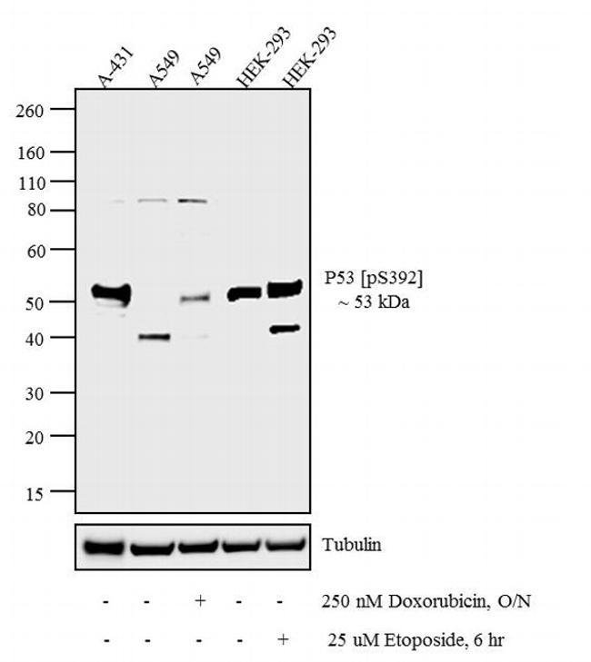 Phospho-p53 (Ser392) Polyclonal Antibody, Invitrogen 100 μL; Unconjugated:Anticorps, | Fisher ...