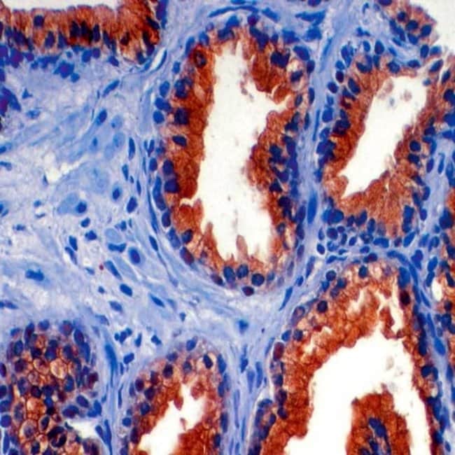 Prostate Specific Acid Phosphatase Psap Monoclonal Antibody Abm312