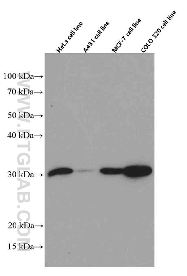 Galectin-3 Mouse anti-Human, Mouse, Rat, Clone: 1C1B2, Proteintech 20 ...