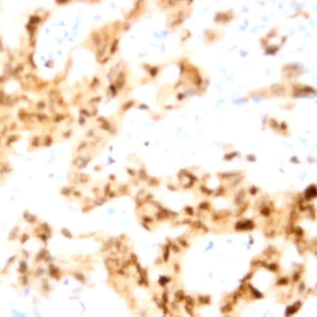 PD-L1 (B7-H1) Monoclonal Antibody (29E.2A3.), Abbomax 100 μg; Unconjugated:Antibodies, | Fisher ...