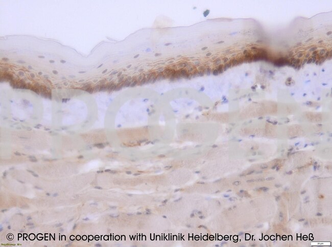 Plakoglobin Monoclonal Antibody (PG 5.1), Progen 200 μL; Unconjugated ...