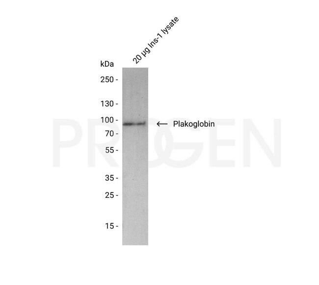 Plakoglobin Monoclonal Antibody (PG 5.1), Progen 200 μL; Unconjugated ...