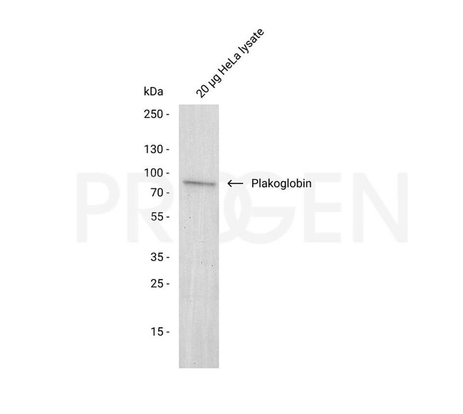 Plakoglobin Monoclonal Antibody (PG 5.1), Progen 200 μL; Unconjugated ...