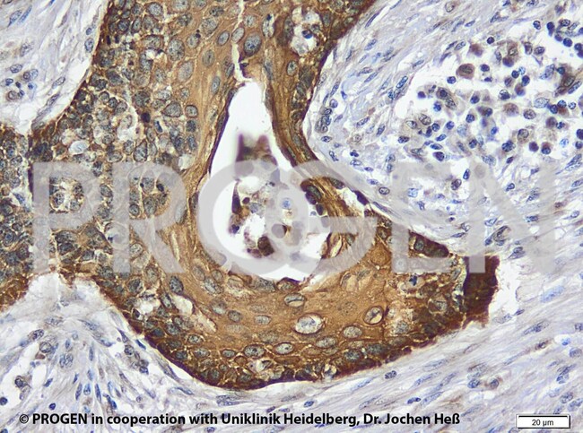 Keratin Type II Monoclonal Antibody (Ks pan1-8), Progen 200 μL ...