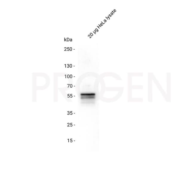 Keratin Type II Monoclonal Antibody (Ks pan1-8), Progen 200 μL ...