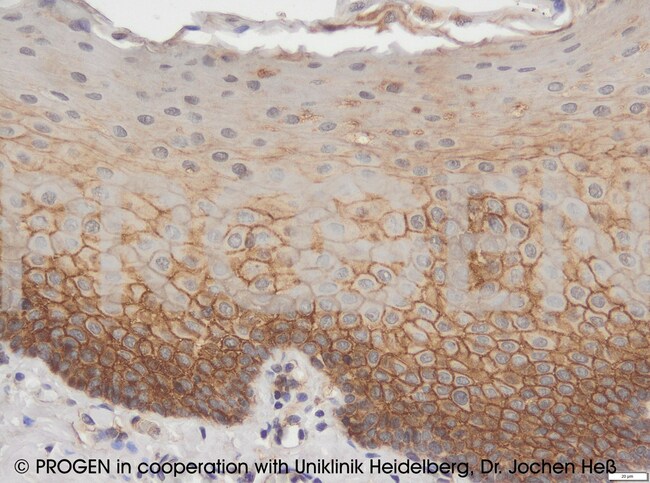 Desmocollin 3 Monoclonal Antibody (Dsc3-U114), Progen:Antibodies ...