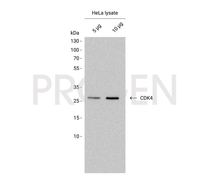 Cyclin-Dependent Kinase 4 Monoclonal Antibody (DCS-156), Progen 1mL; Unconjugated:Antibodies ...