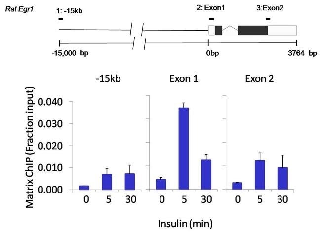 Phospho-p70 S6 Kinase (Thr421, Ser424) Recombinant Rabbit Monoclonal Antibody | Fisher Scientific