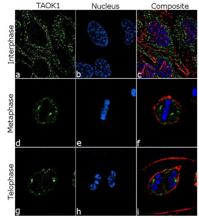 TAOK1 Recombinant Rabbit Monoclonal Antibody (13H2L16), Invitrogen 100 ...